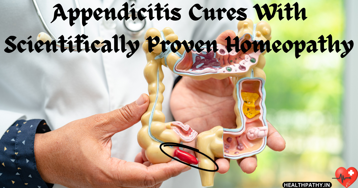 Appendicitis Cures With Scientifically Proven Homeopathy » HealthPathy